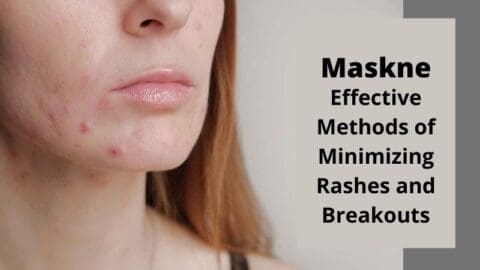 Maskne: Effective Methods of Minimizing Rashes and Breakouts | Winston ...