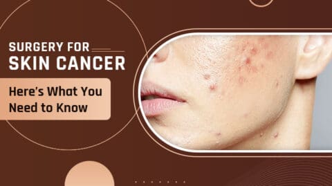 Surgery for Skin Cancer - Here’s What You Need to Know | Winston Salem ...