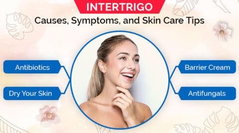 Intertrigo: Causes, Symptoms, and Skin Care Tips | Winston Salem ...